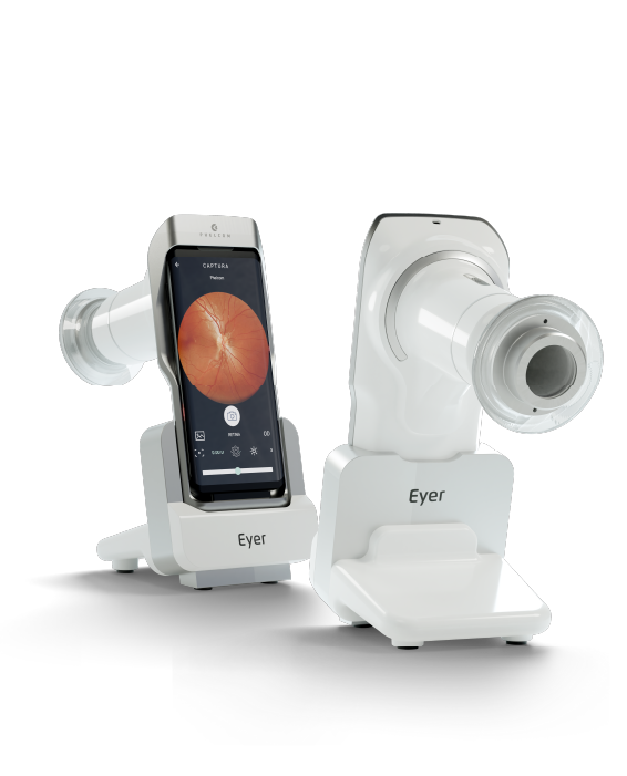 Cámara Retinal Portátil Eyer - Phelcom | Internacional